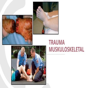 Trauma Muskuloskeletal pada kegawatdaruratan.pptx
