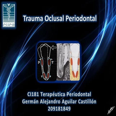 Trauma Oclusal -Terapéutica Periodontal -Germán Alejandro Aguilar ...