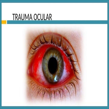 Urgencias oftalmológicas: Trauma ocular. | PPTX