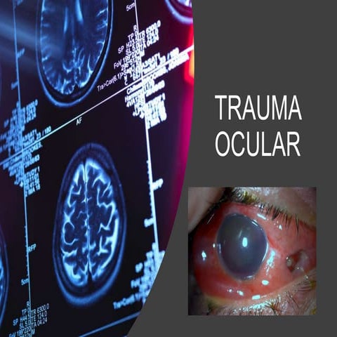 Trauma Ocular 1.pptx