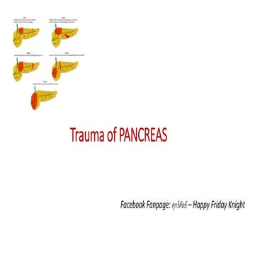 Trauma of PANCREAS | PPTX