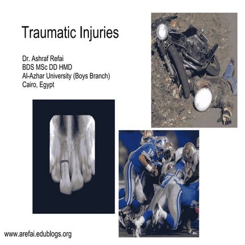 Traumatic Injuries | PPTX