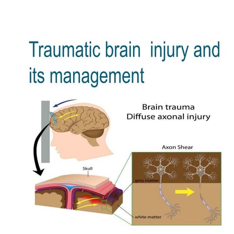 Traumatic brain injury | PPTX