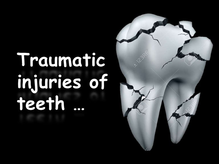 Traumatic injuries of teeth