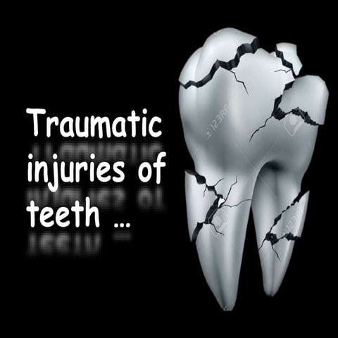 Traumatic injuries of teeth | PPTX
