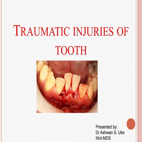 Traumatic Injuries to Teeth.pptx