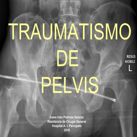 Traumatismo de pelvis | PPT