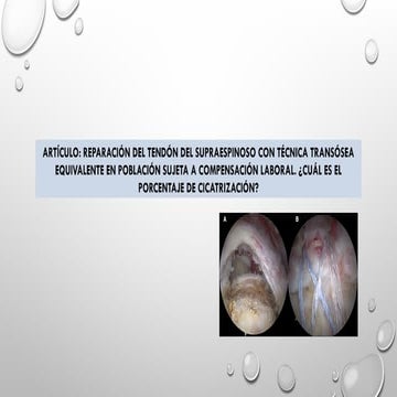 reparacion del tendon supraespinoso con tecnica transosea.pptx
