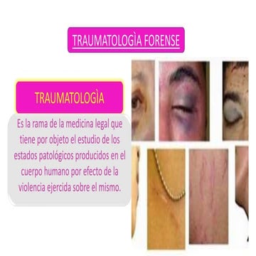 traumatologia forense Es la rama de la medicina legal | PPTX