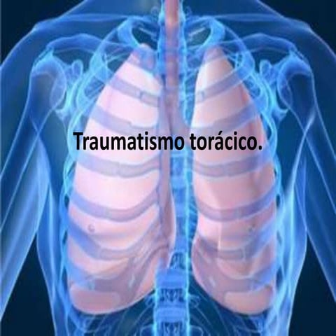 Traumatismo toracico | PPTX