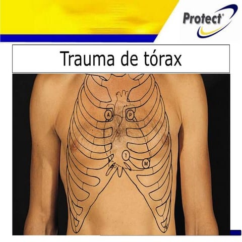 Manejo del trauma de tórax