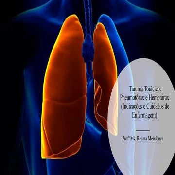 Trauma Torácico.pptx