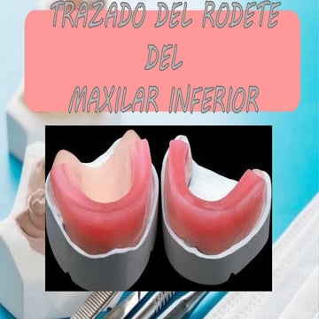 TRAZOS DEL MAXILAR INFERIOR.pptx
