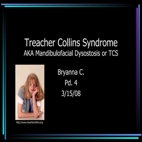 Treacher Collins | PPT