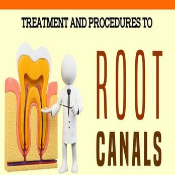Treatment and procedures to root canal therapy | PPT