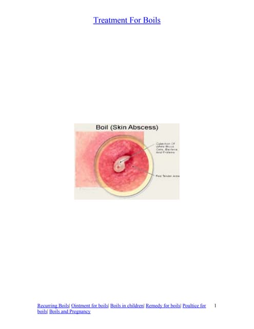 What are stings and insect bites | PPTX