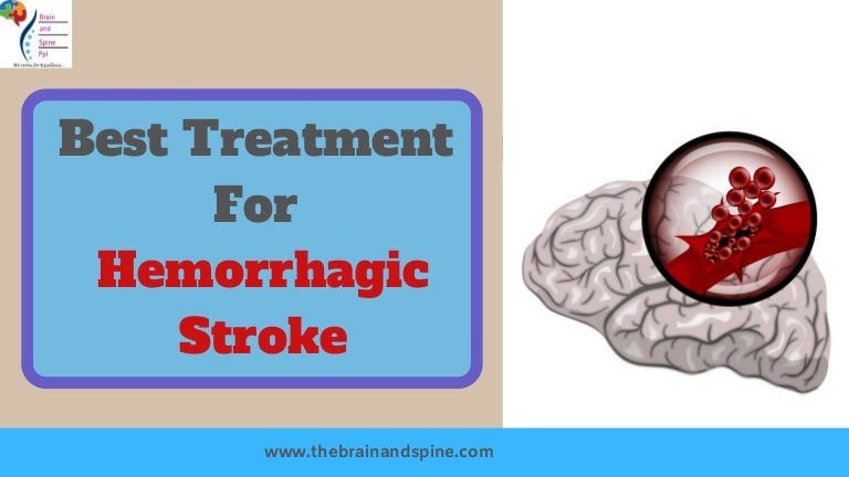 Best Treatment Option For Hemorrhagic Stroke