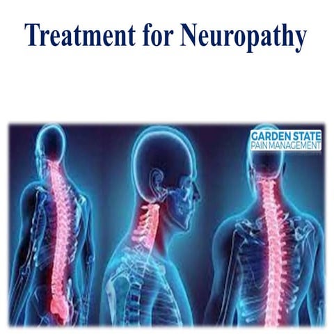 Treatment for Neuropathy.pptx