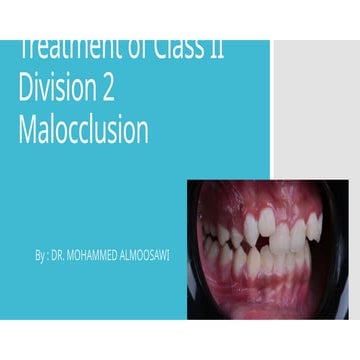 Treatment of Class II Division 2 Malocclusion.pptx