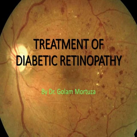 Treatment of Diabetic Retinopathy.pptx