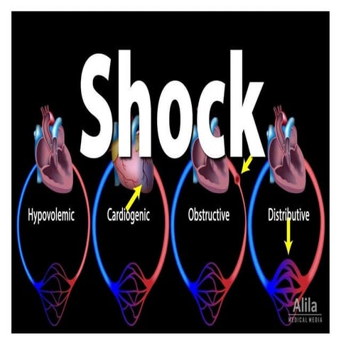 Treatment of shock | PPT
