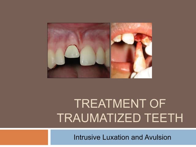 Traumatic Dental Injury and Treatment | PPT
