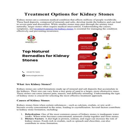 Treatment Options for Kidney Stones.pdf... | PDF