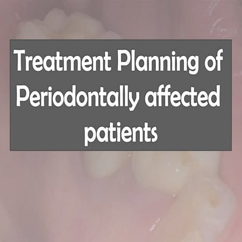 Treatment Planning of periodontally affected patients | PDF