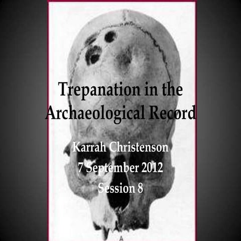 Trepanation Presentation by Karrah Christenson Session 8 2012 | PPT