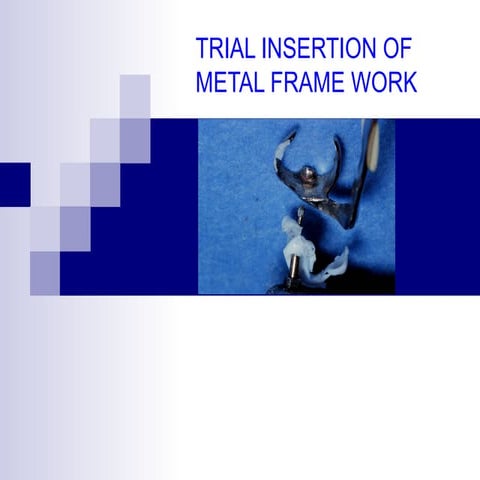Insertion of Metal Framework | PPT