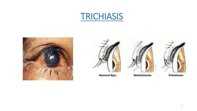 Tests done to assess patency of lacrimal drainage | PPTX
