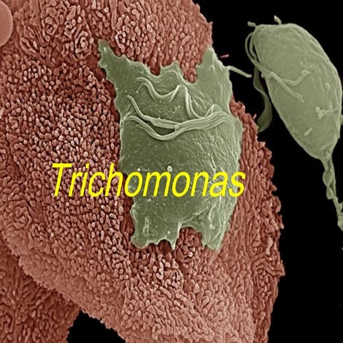 Trichomonas | PPT