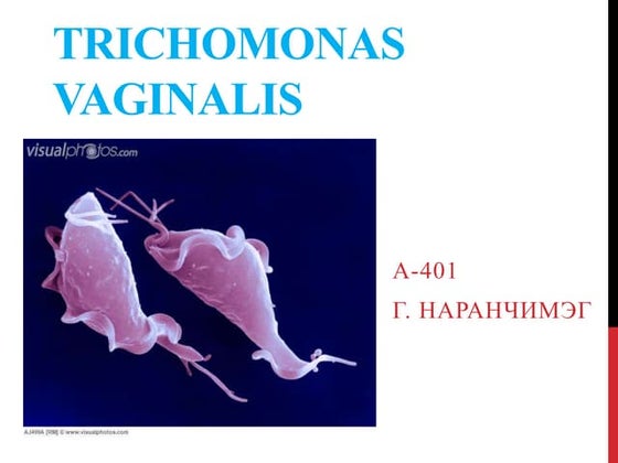 Trichomonas | PPTX