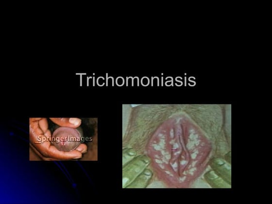 Trichomoniasis | PPTX | Reproductive Health | Diseases and Conditions