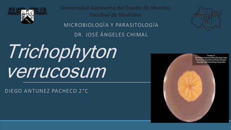 Trichophyton Verrucosum