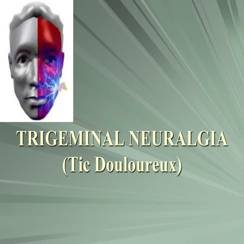 trigeminal neuralgia | PPTX