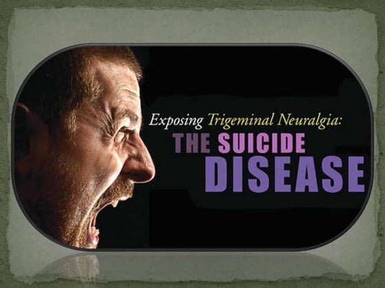 Signs, symptoms and treatment of Trigeminal Neuralgia | PPT