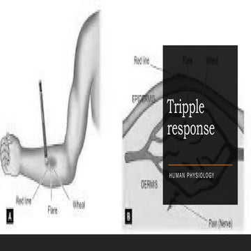 triple response on skin based on physiology | PPTX