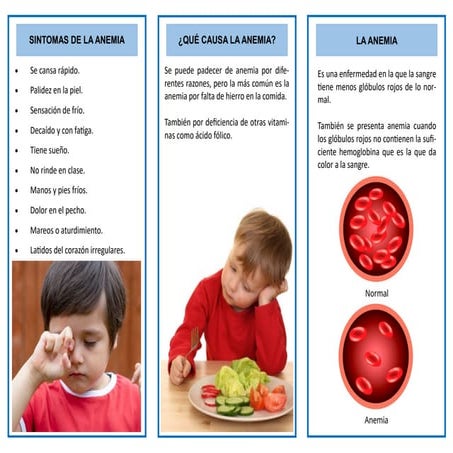 TRIPTICO LA ANEMIA.pdf