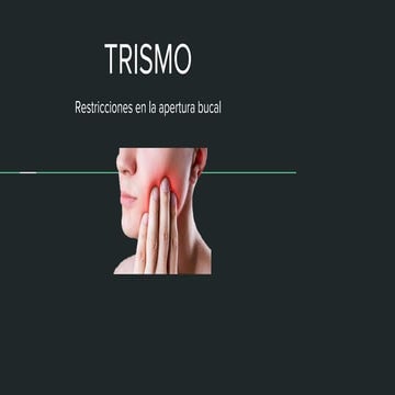 Trismus.pptx