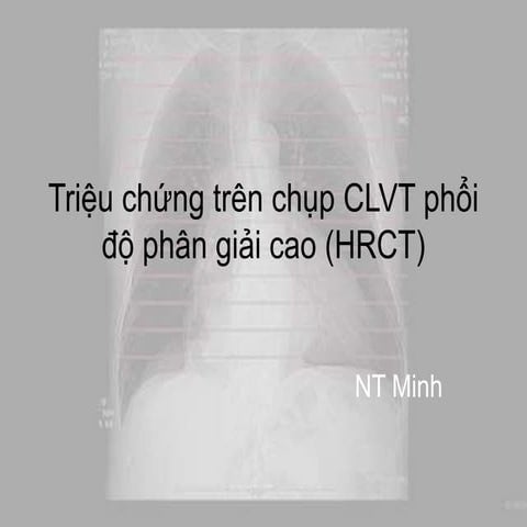 Giải phẫu cột sống và hình ảnh chấn thương cột sống trên clvt | PPT