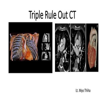 Cardiac mri&slice anatomy | PPT