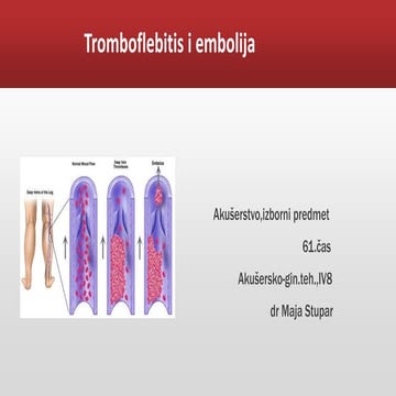 Tromboflebitis i embolija | PPTX
