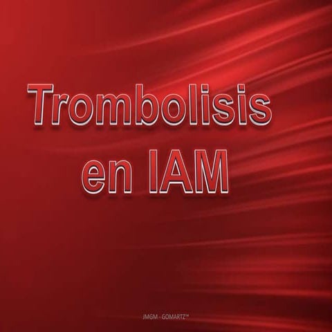 Trombolisis en Paciente con IAM | PPTX