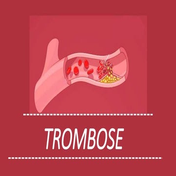 Trombose | PPTX