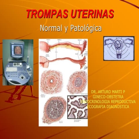 Trompas uterinas, normal y patologico.pdf