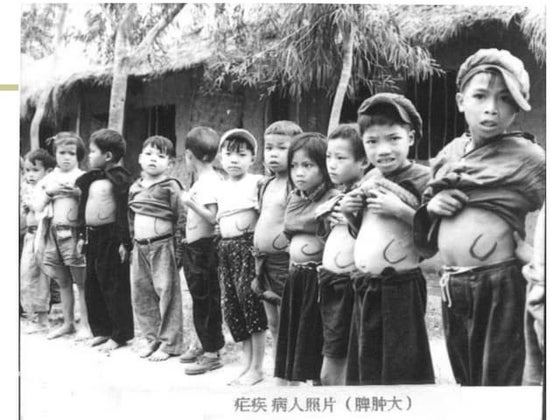 Harrison sulcus | PDF