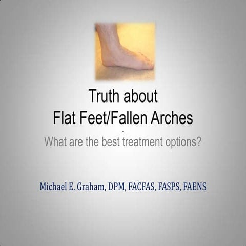 Flat Feet Treatment Options | PPTX