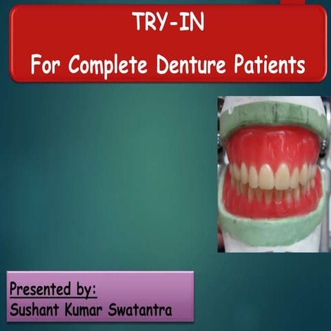 Try in of complete dentures | PPTX