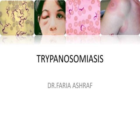 trypanosomiasis-sleepin sickness & chagas dise | PPT